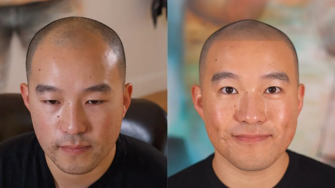 Everything You Need to Know About Hairline Tattoos: A Comprehensive ...