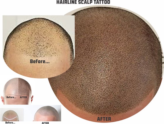 Everything You Need to Know About Hairline Tattoos: A Comprehensive ...