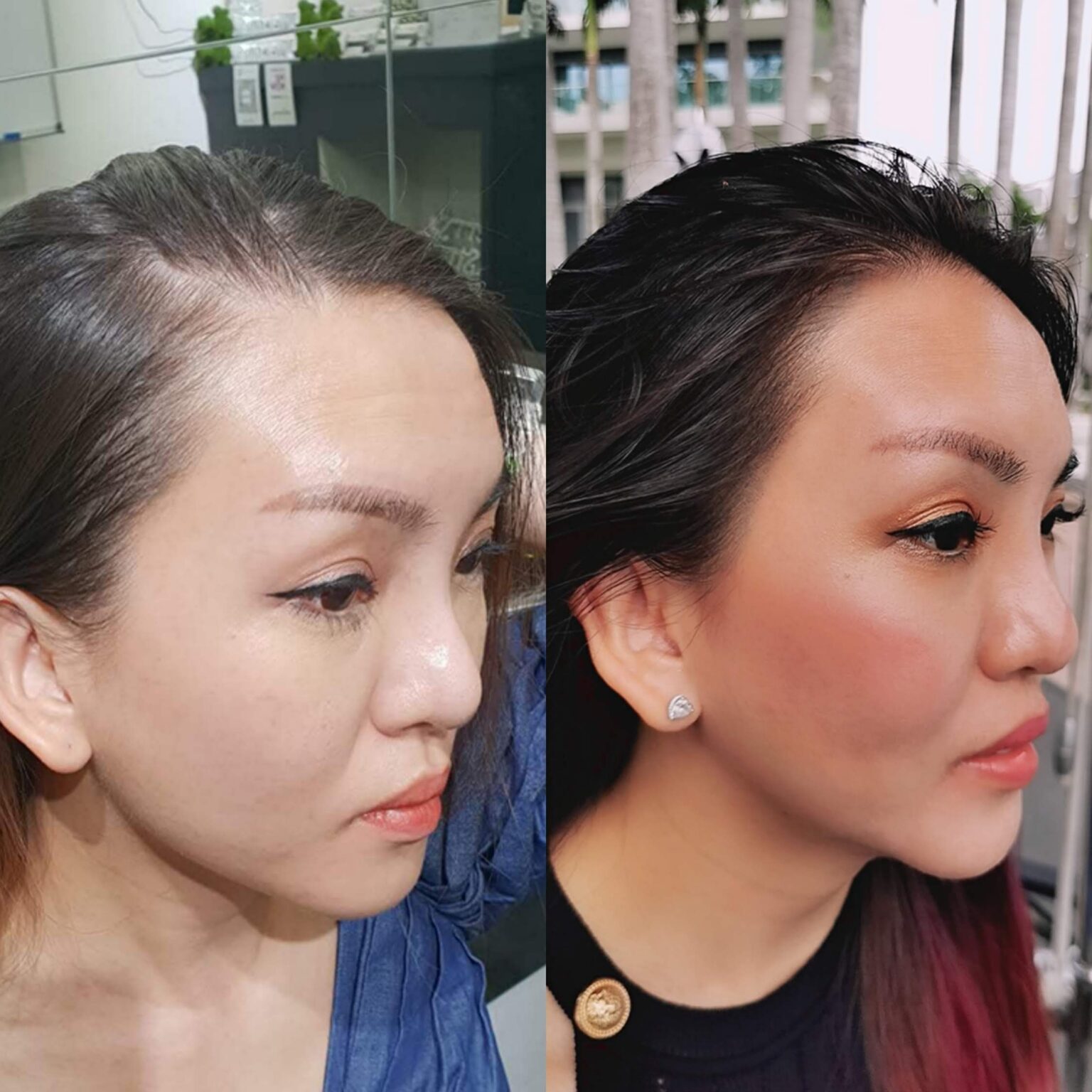Everything You Need to Know About Hairline Tattoos: A Comprehensive ...