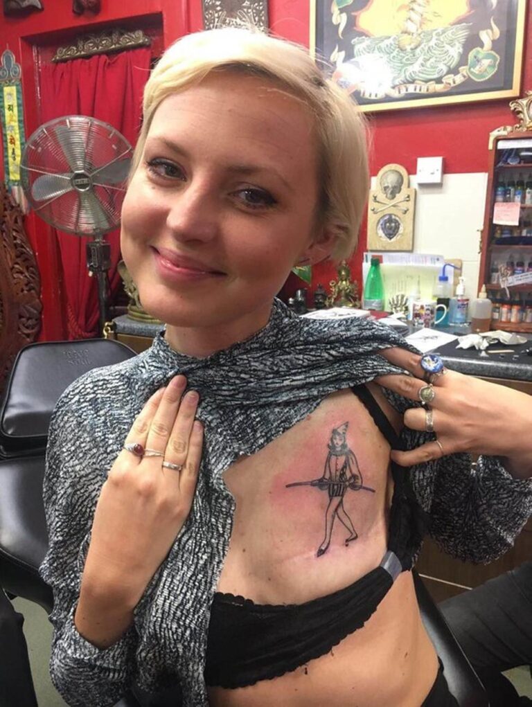 Scar Tattoo: A Comprehensive Guide to Transforming Scars into ...